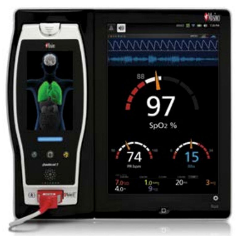 Masimo Root Monitor