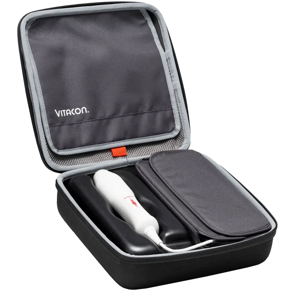 Vitacon VitaScan LT Bladder Scanner